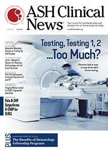 Iberdomide: A New Immunomodulatory Drug for Heavily Refractory Myeloma ...