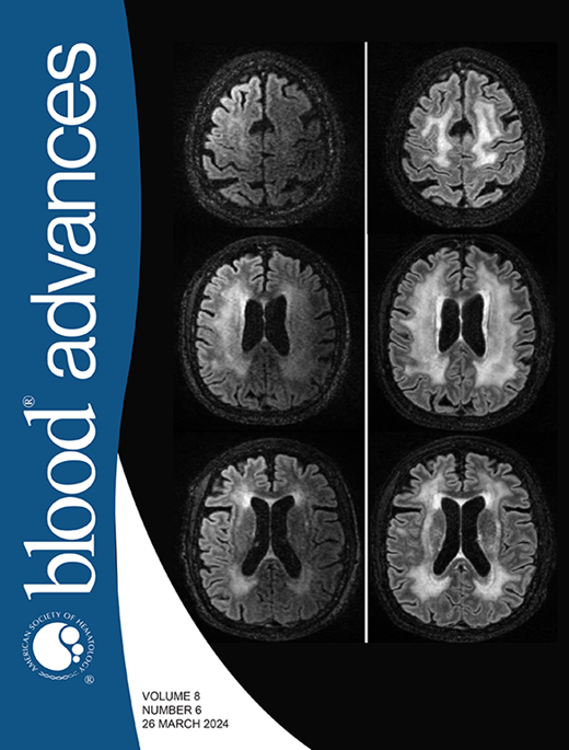 Liver abnormalities are frequent and persistent in patients with ... Liver abnormalities are frequent and persistent in patients with ...